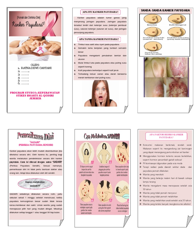 Leaflet Ca Mamae | PDF