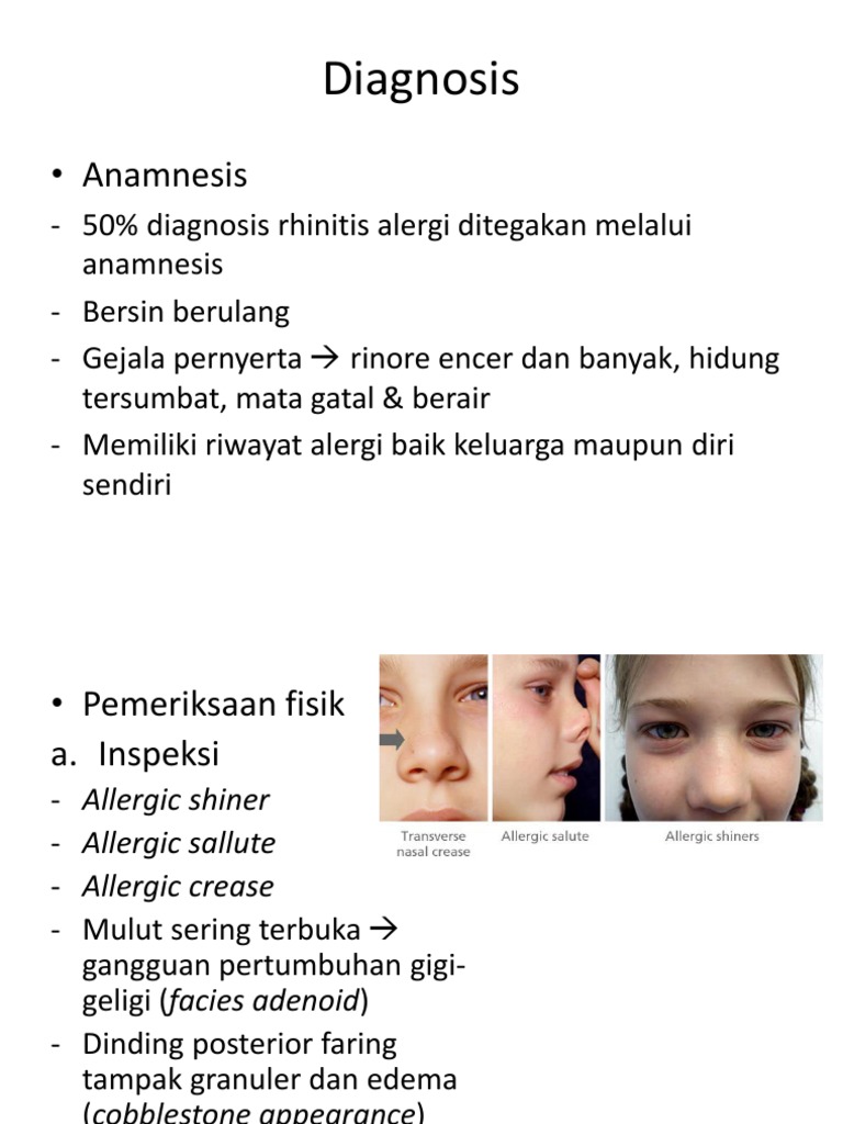 Diagnosis Rhinitis Alergi | PDF