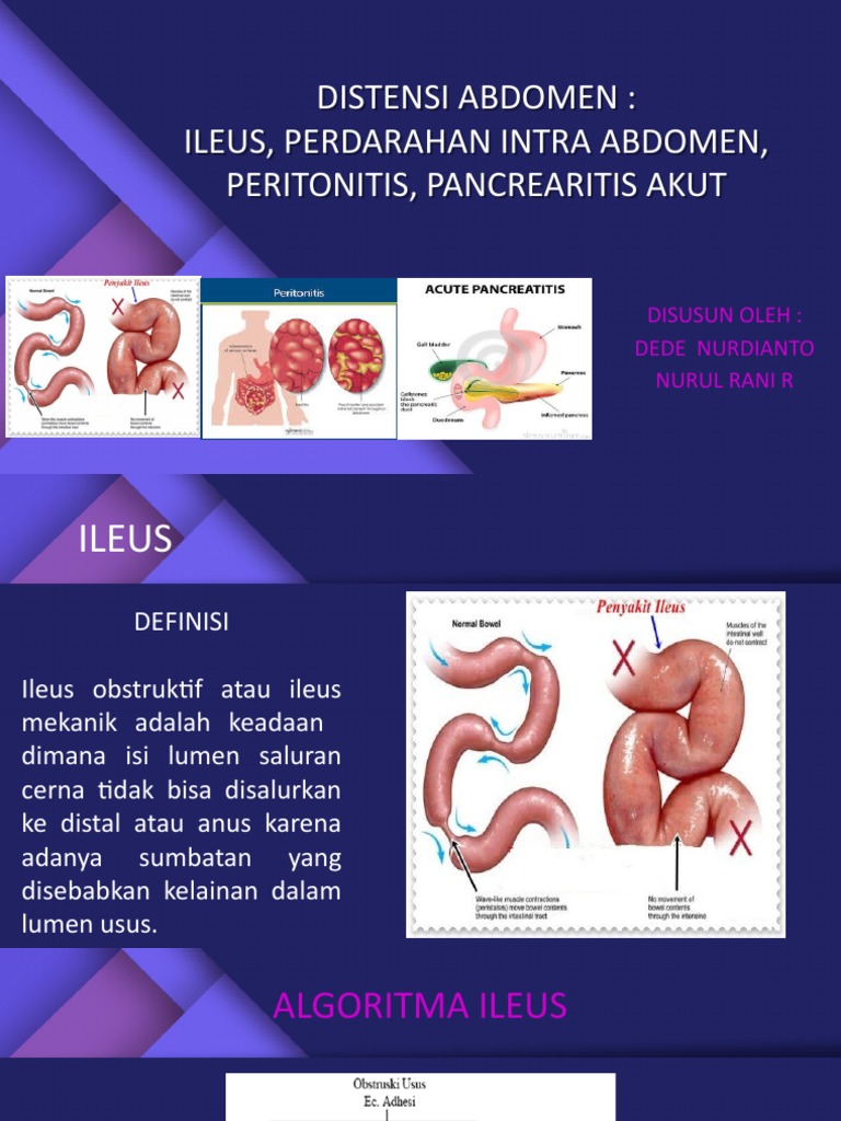 Penyebab dan Penanganan Distensi Abdomen | PDF