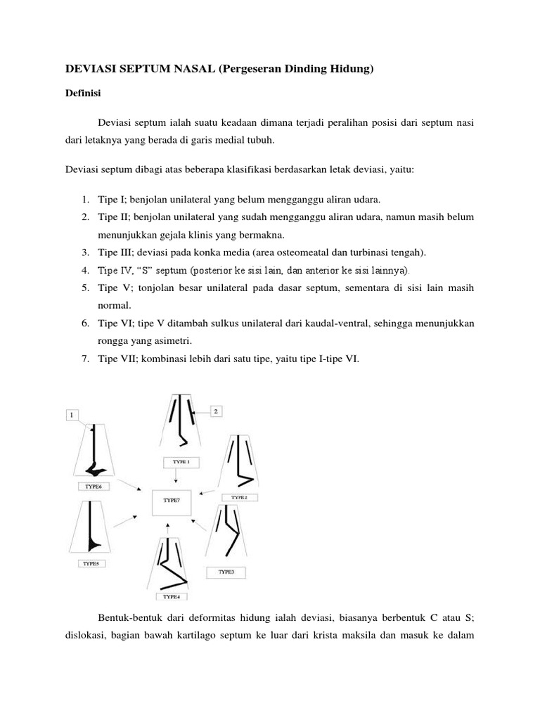Deviasi Septum Nasal | PDF