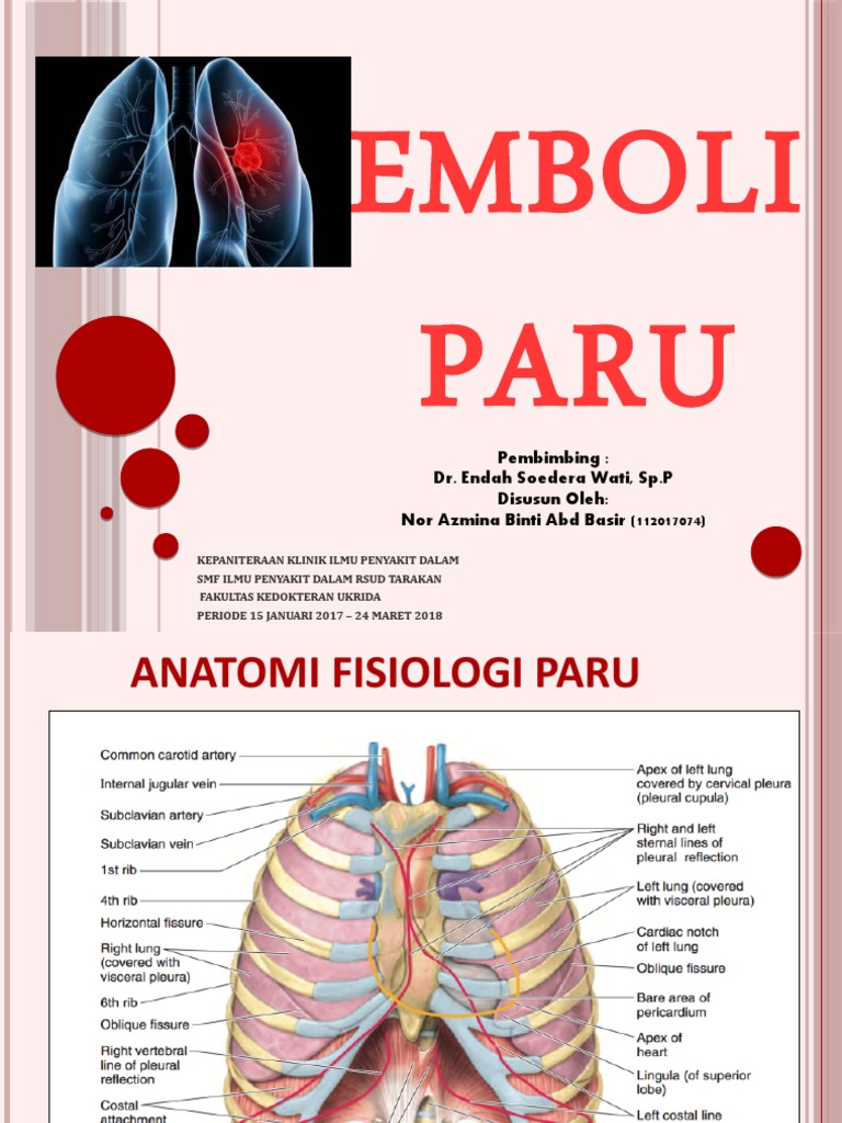 PPT Emboli | PDF