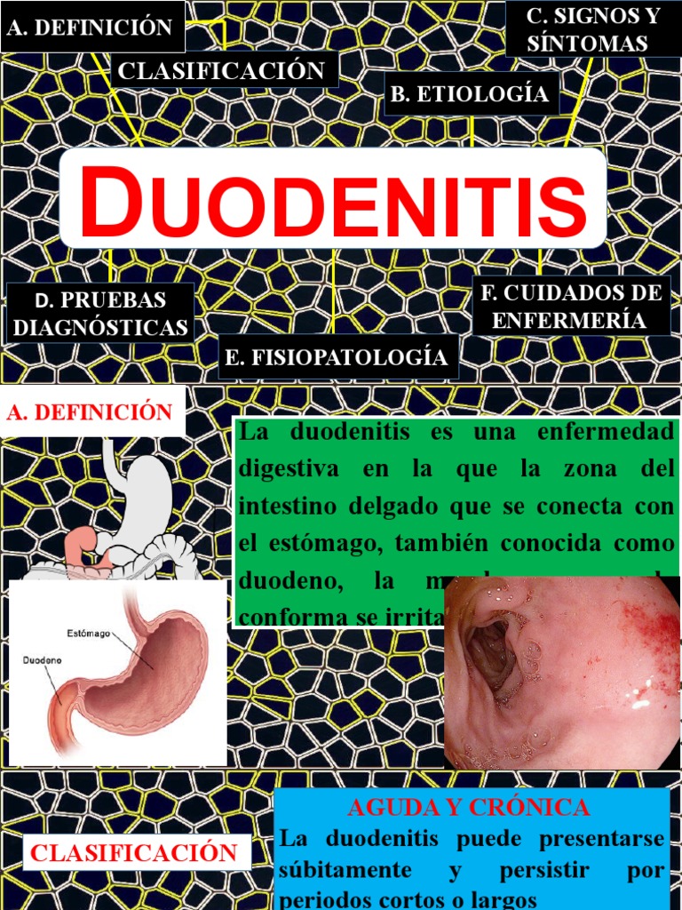 Duodenitis | PDF | Estómago | Aspirina