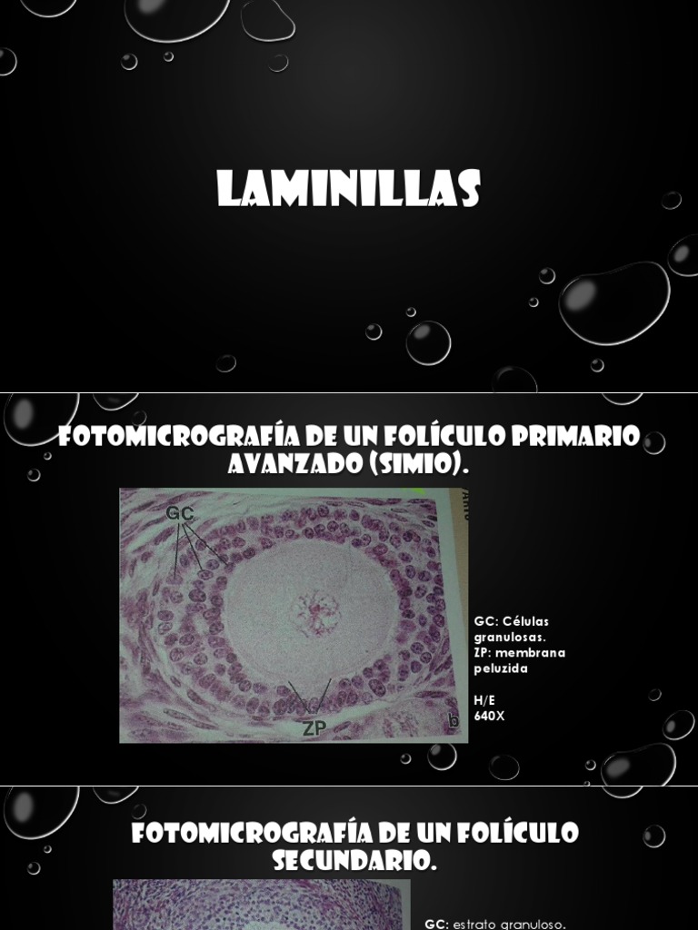 La Minillas | PDF