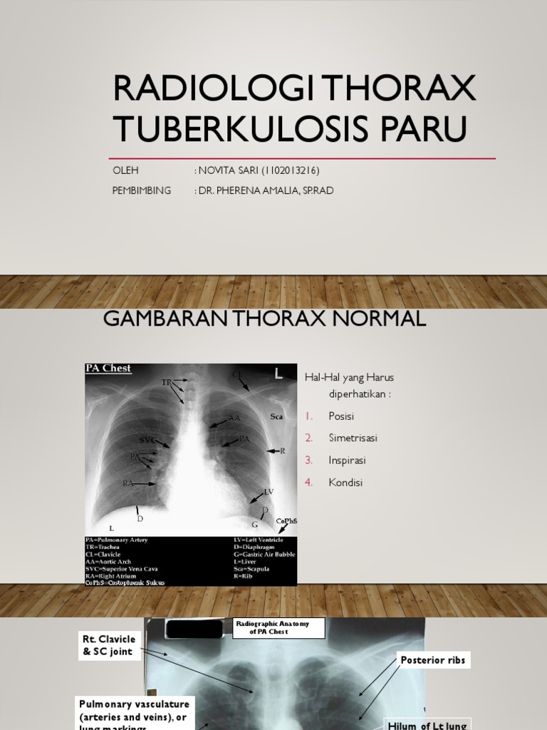 Gambaran Radiologi TB Paru Aktif | PDF