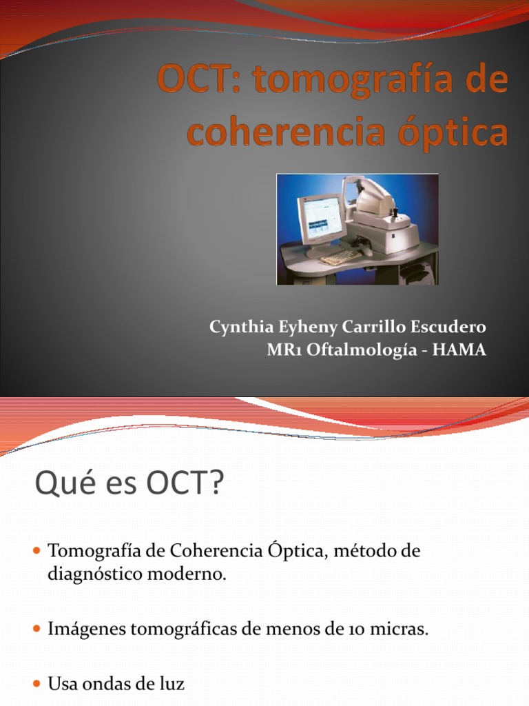 Capas de La Retina en OCT | PDF