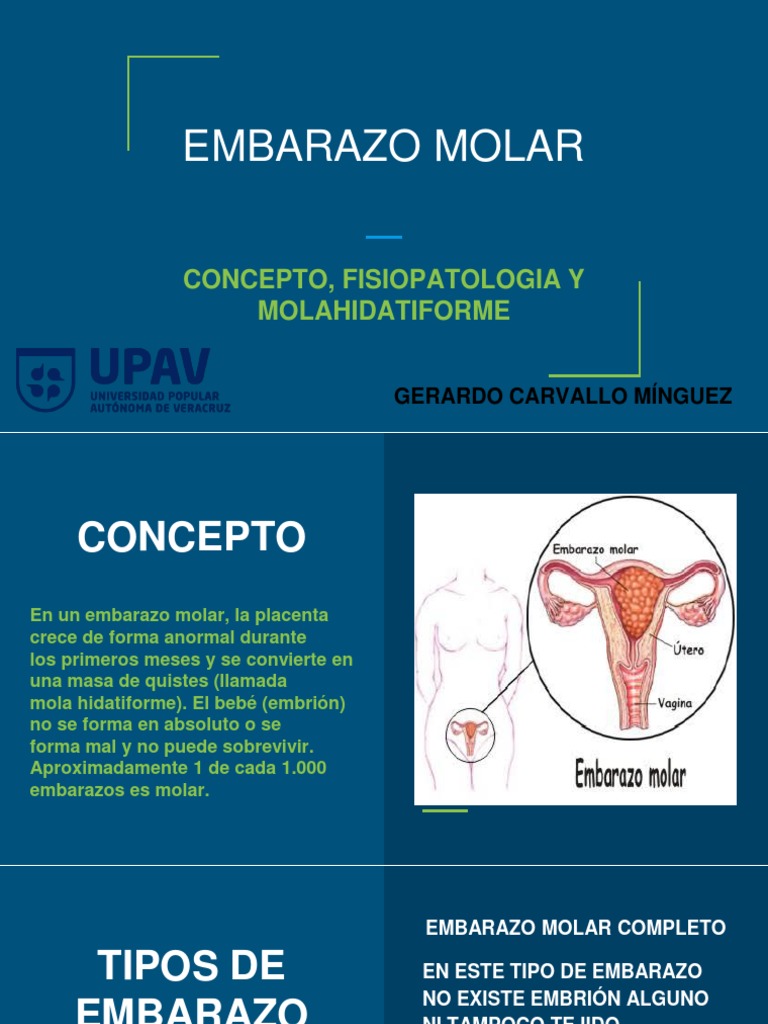 Embarazo Molar
