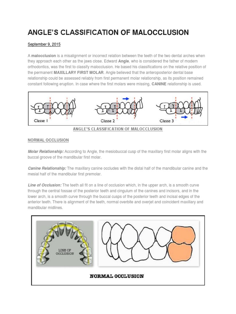Angle Clasification | PDF | Mouth | Orthodontics