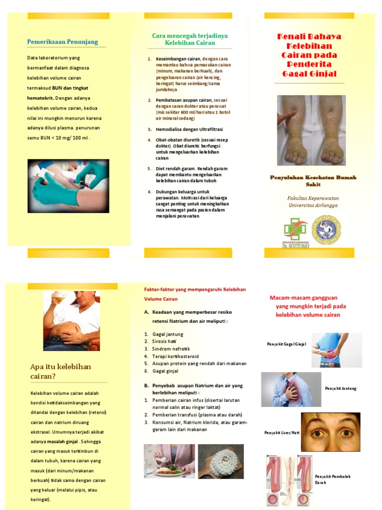 Leaflet Kelebihan Volume Cairan PDF | PDF