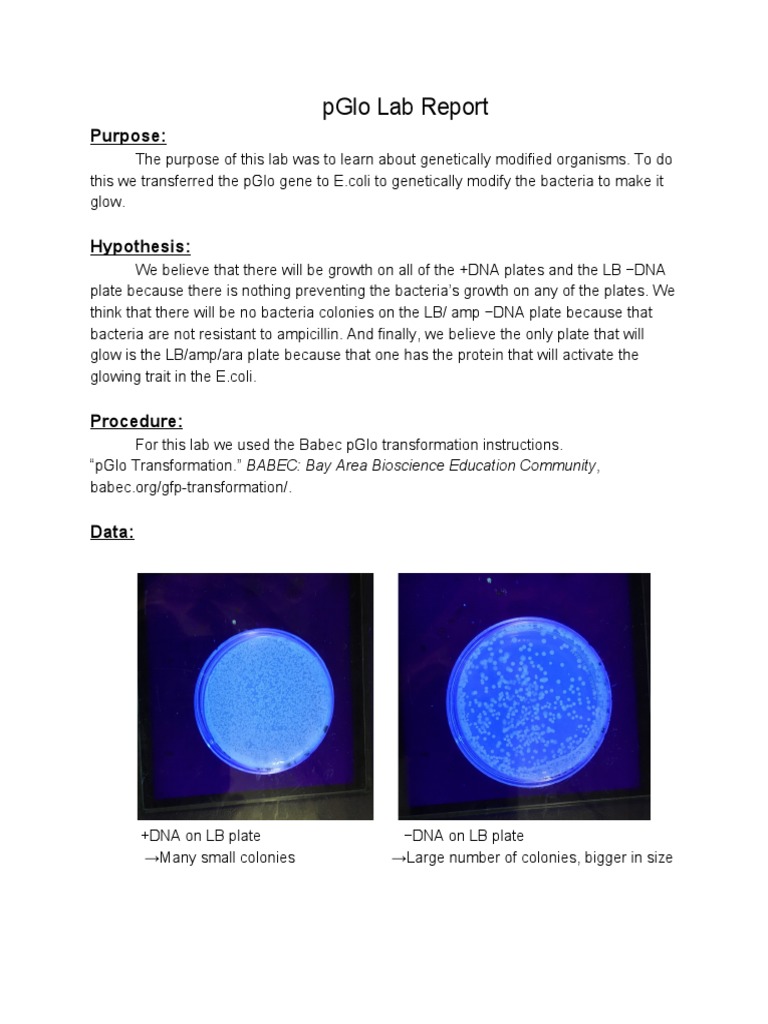 Pglo Lab Report | PDF | Transformation (Genetics) | Bacteria