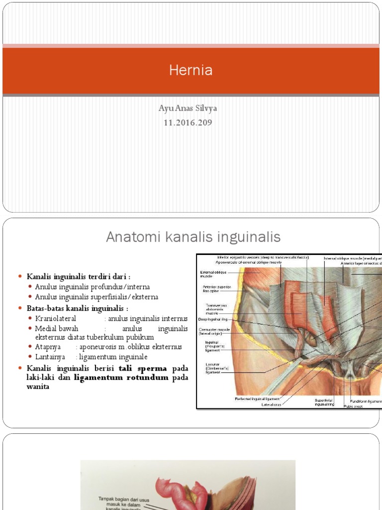 Hernia | PDF