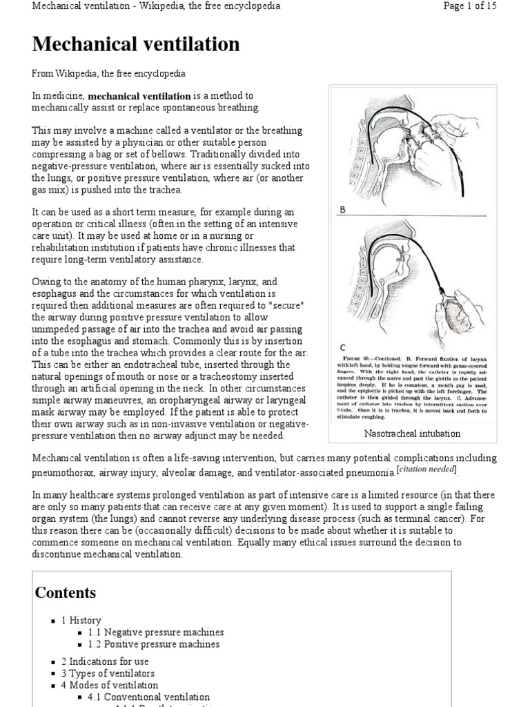 Mechanical Ventilation Wiki | PDF | Breathing | Pulmonology