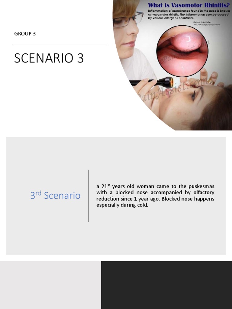 Vasomotor Rhinitis in a 21-Year-Old Woman | PDF | Human Nose | Allergy