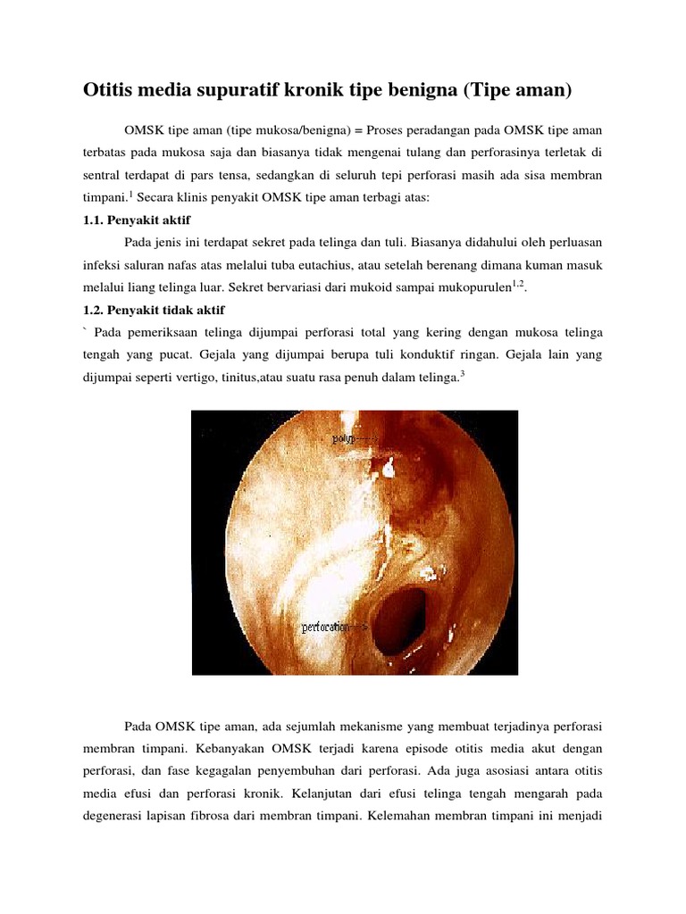 Omsk Tipe Aman | PDF