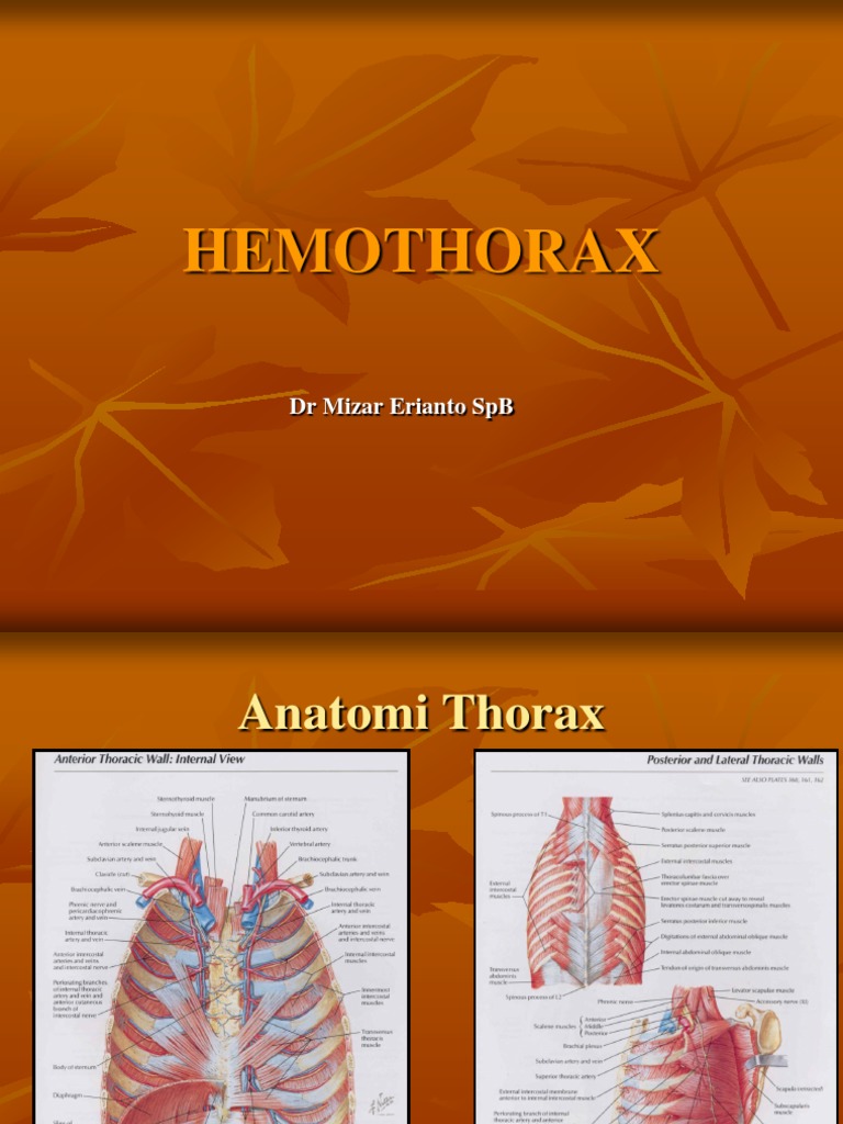 Hemothorax: Diagnosis dan Terapi | PDF | Sains & Matematika