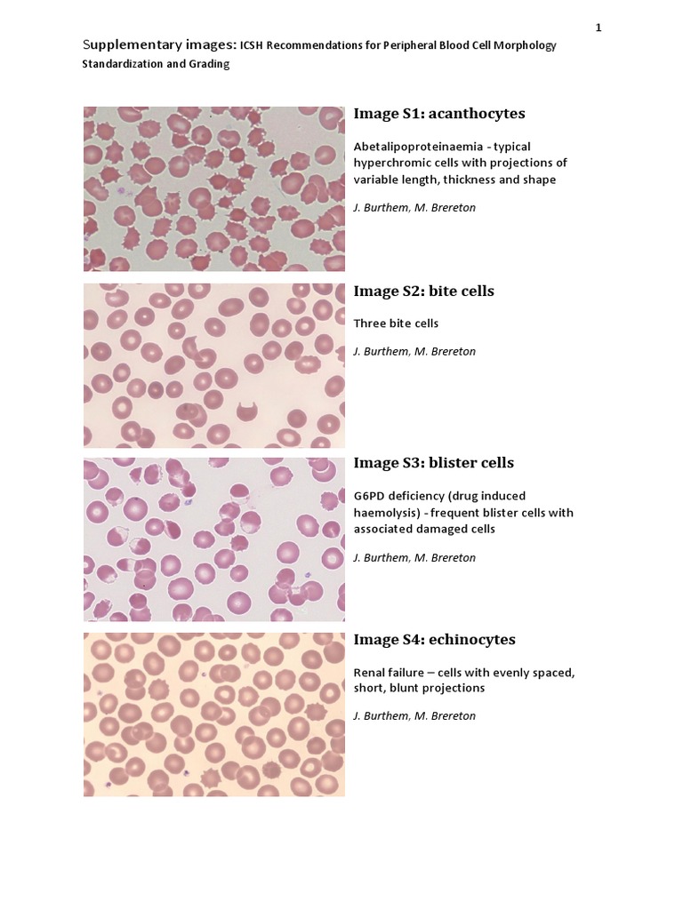 ICSH Recommendations for Peripheral Blood Cell Morphology ...