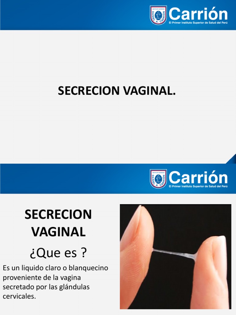 Secrecion Vaginal 110 0 | Descargar gratis PDF | Vagina | Las bacterias Secrecion Vaginal 110 0 | Descargar gratis PDF | Vagina | Las bacterias