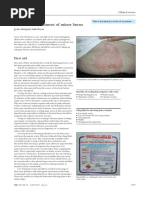 Bitumen Burn First Aid Guide | PDF | Burn | Asphalt