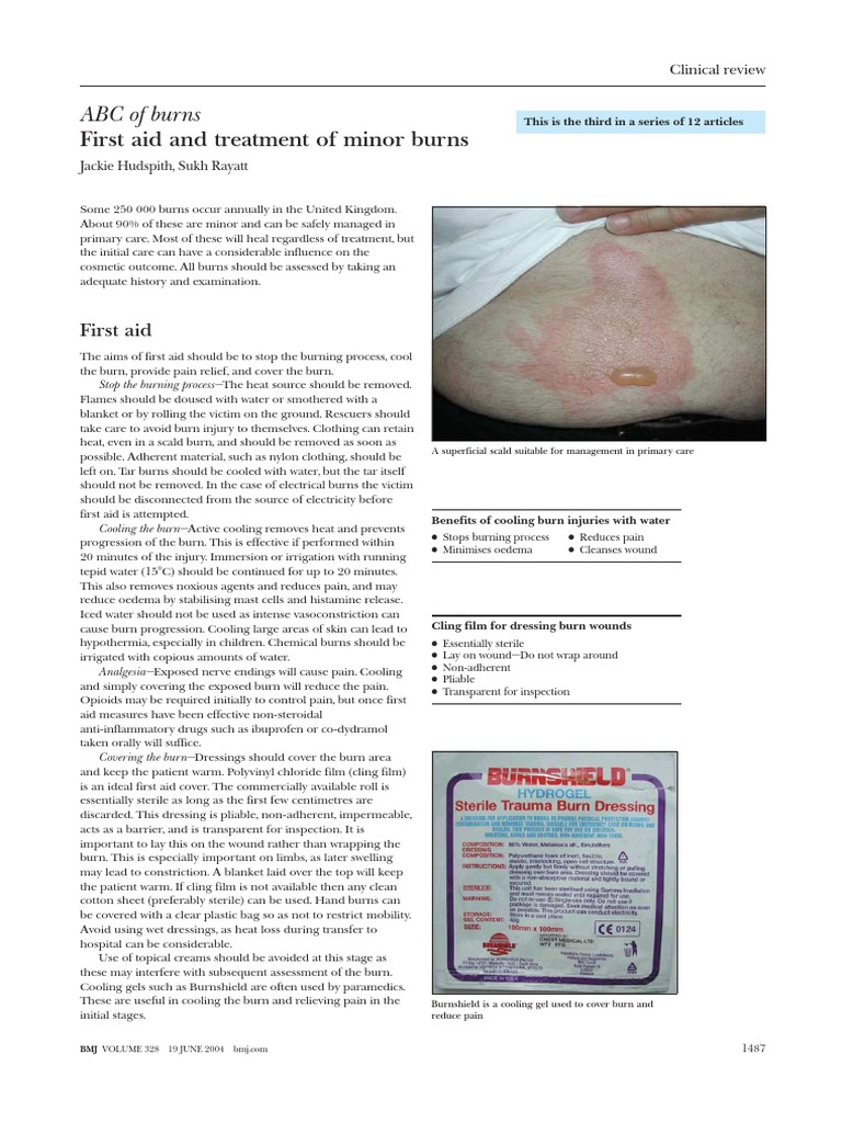 ABC of Burns First Aid and Treatment of Minor Burns | PDF | Burn | Wound
