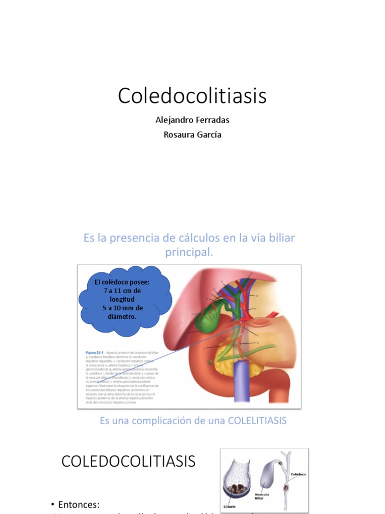 Coledocolitiasis: Diagnóstico y Tratamiento | PDF | Vesícula biliar ...