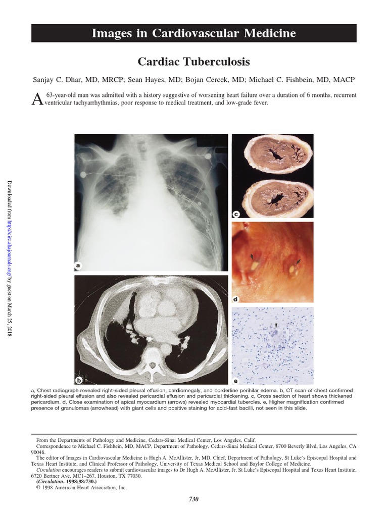 Images in Cardiovascular Medicine: Cardiac Tuberculosis | PDF | Cardiac ...