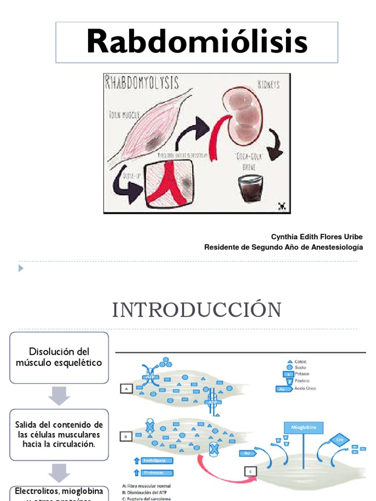 Rabdomiólisis: Causas y Diagnóstico | PDF | Anatomía | Medicina