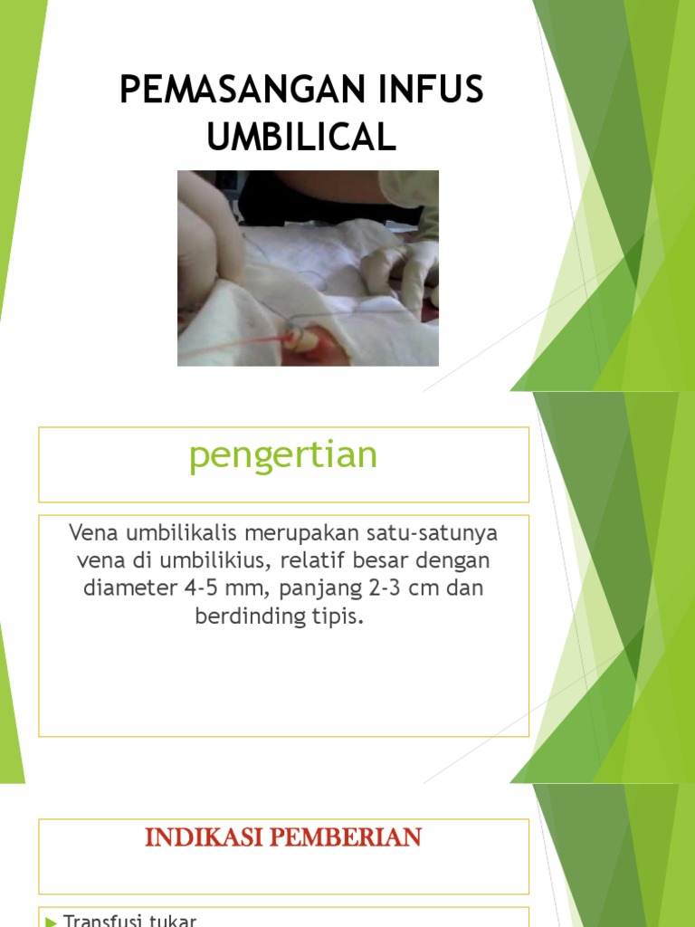 Pemasangan Infus Umbilical | PDF