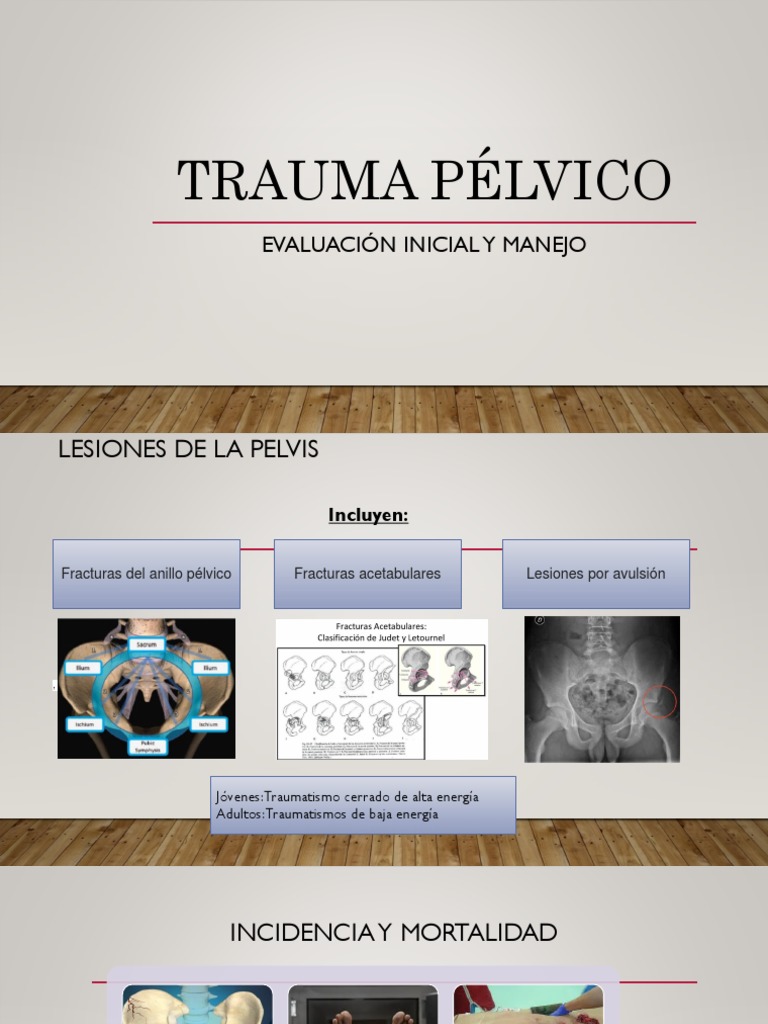 Trauma Pélvico | Pelvis | Lesión