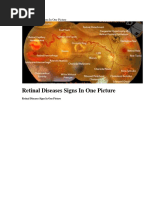 White Without Pressure | PDF | Vision | Ophthalmology