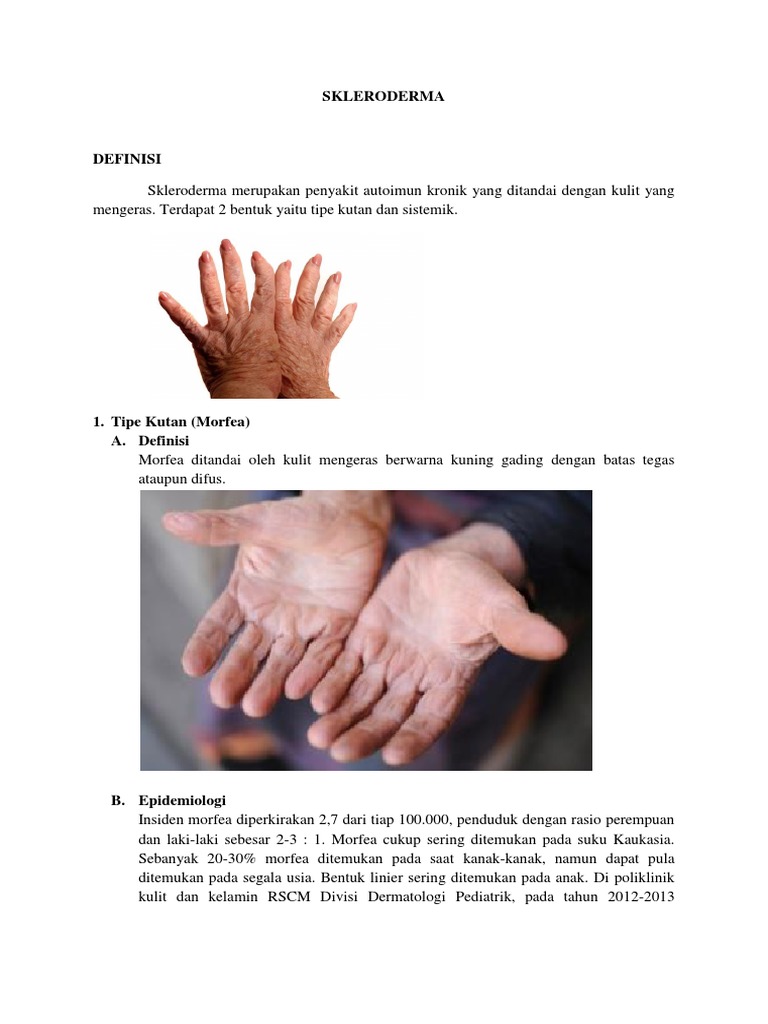 Skleroderma | PDF