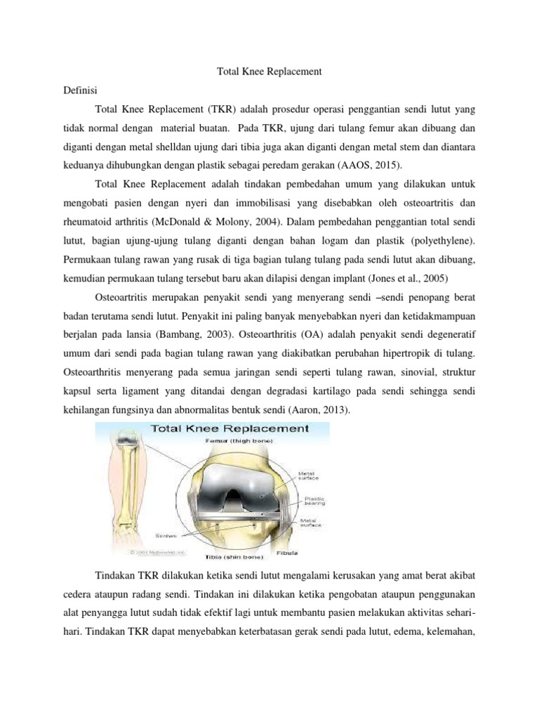 Total Knee Replacement | PDF | Kesehatan Holistik | Sains & Matematika