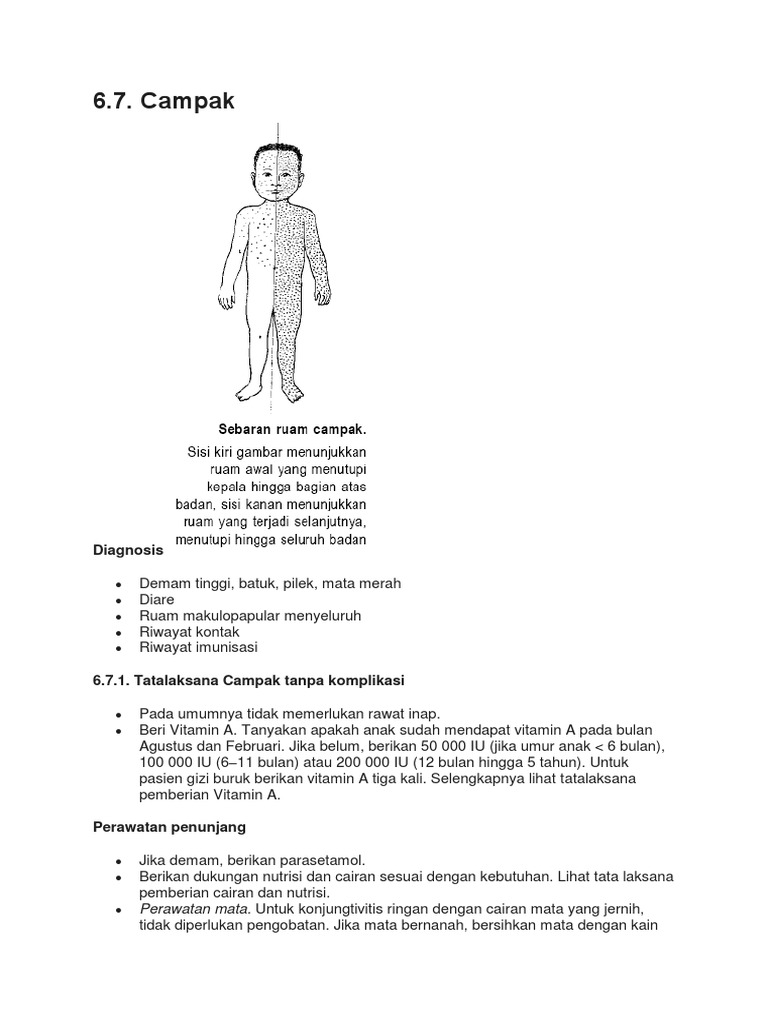 Tatalaksana Campak pada Anak dan Dewasa | PDF
