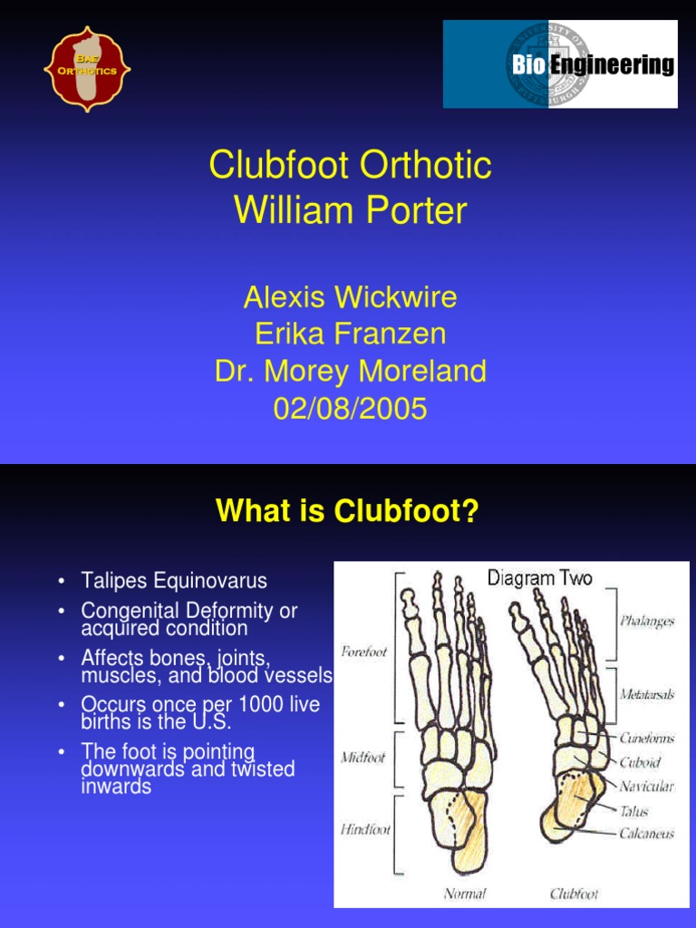 Club Foot | PDF | Musculoskeletal System | Medical Specialties