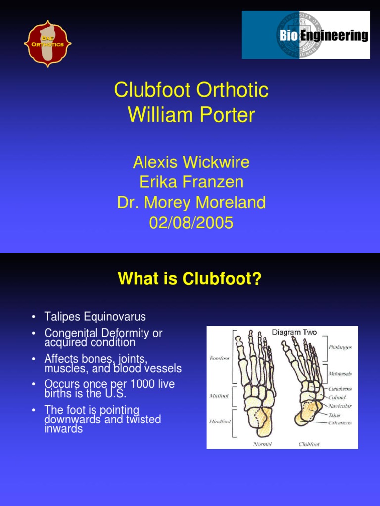 Clubfoot Orthotic William Porter: Alexis Wickwire Erika Franzen Dr ...