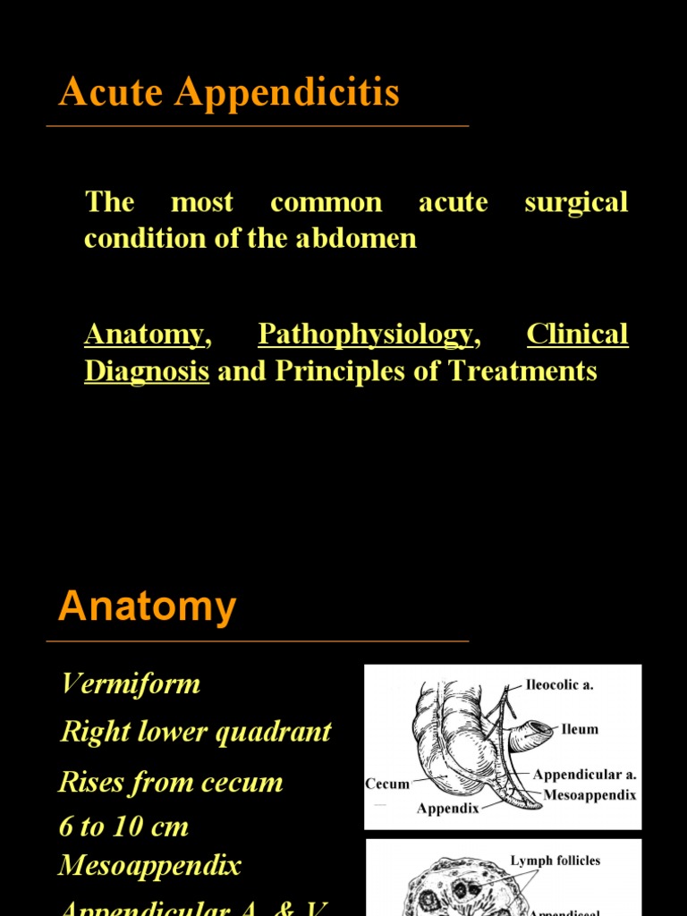 Acute Appendicitis: Diagnosis & Treatment | PDF | Digestive Diseases ...