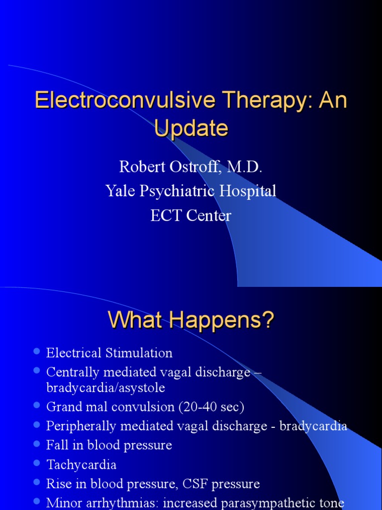 Ect Presentation | Electroconvulsive Therapy | Major Depressive Disorder