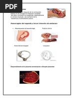 Efecto Poseiro | PDF | Placenta | Feto
