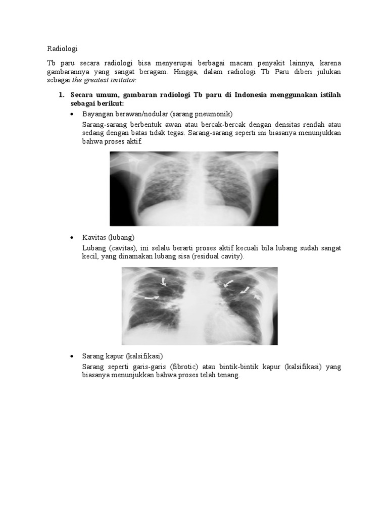 TB Radiologi | PDF | Sains & Matematika