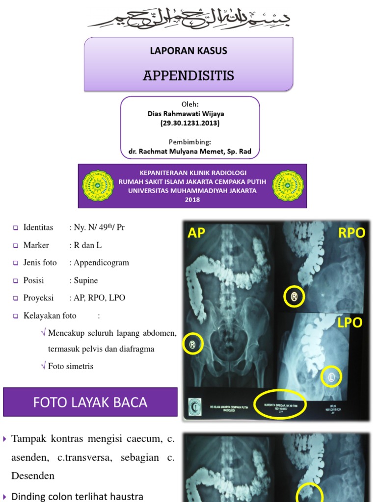 Laporan Kasus Appendisitis | PDF