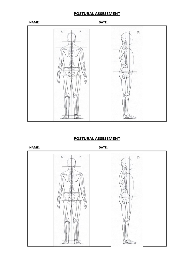 Postural Assessment Form | PDF | Sports & Recreation