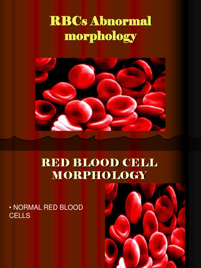 RBCs Abnormal Morphology | Anemia | Red Blood Cell | Free 30-day Trial ...
