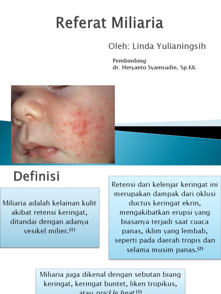 Referat Miliaria FIX | PDF