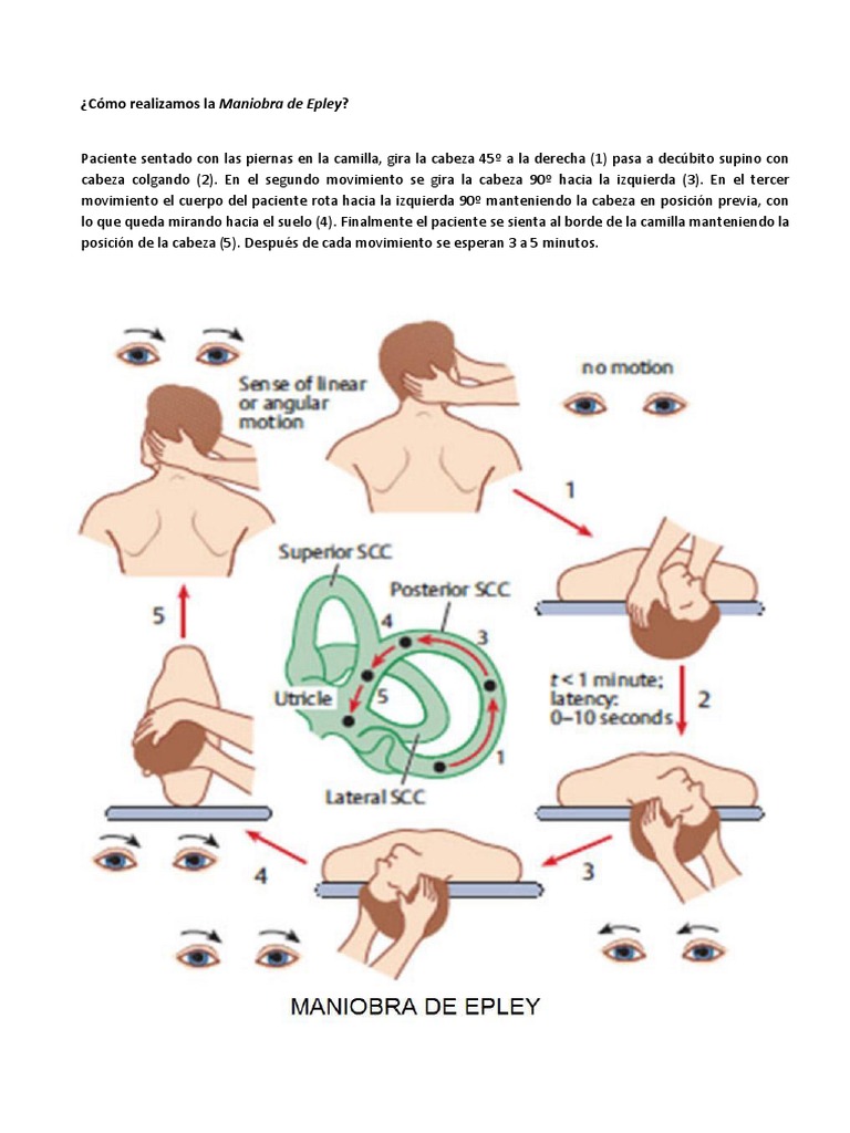 Maniobra de Epley Para Vértigos
