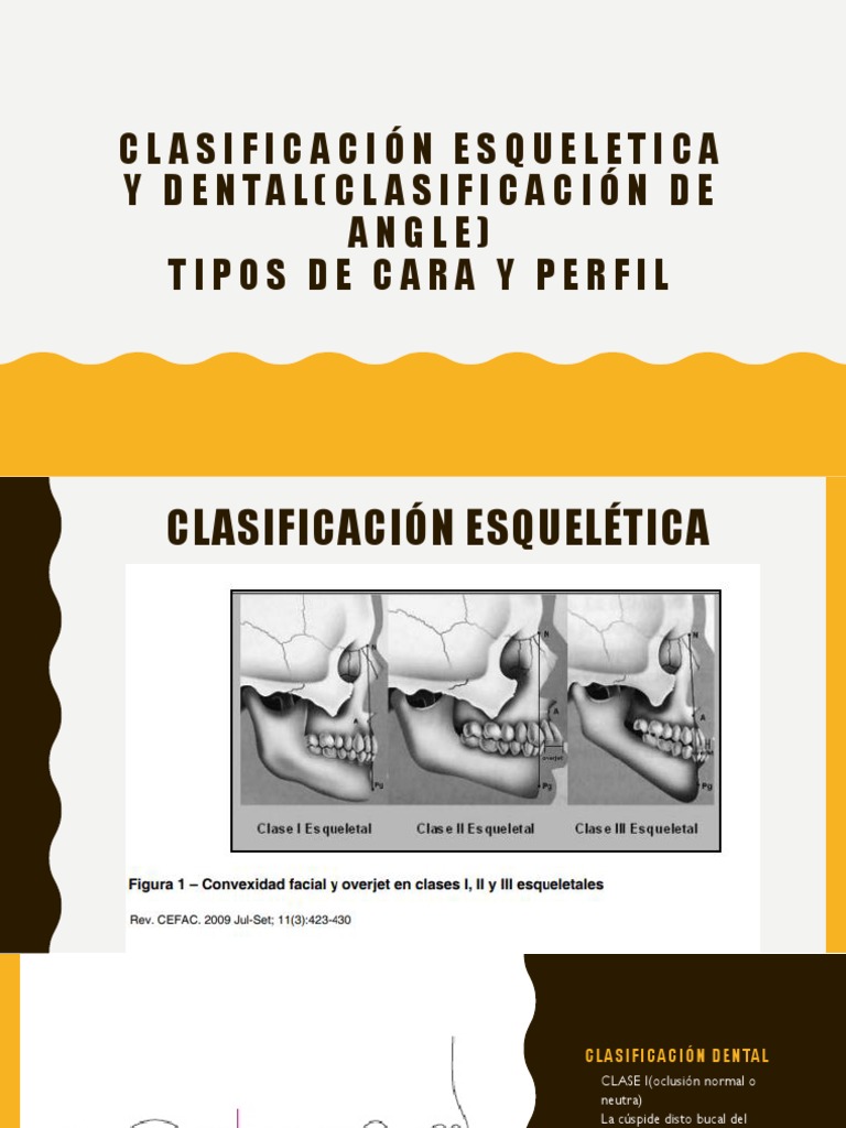 Clasificación Esquelética y Dental | PDF