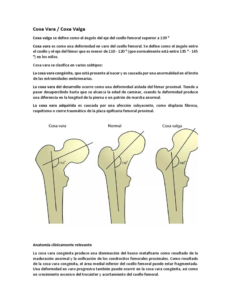 Coxa Vara y Coxa Valga: Definición y Tratamiento | PDF | Cadera ...