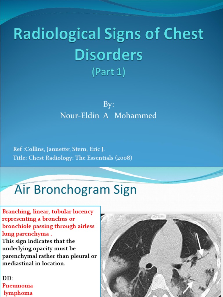 Radio Logical Chest Signs | PDF | Lung | Pulmonology