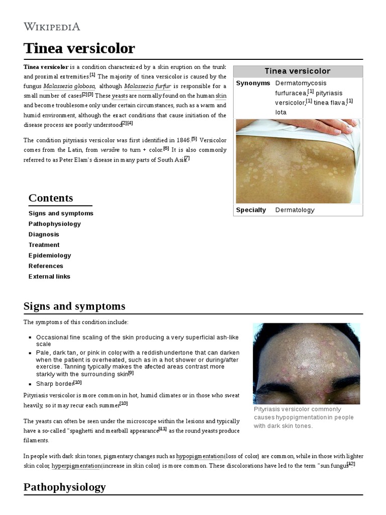 Tinea Versicolor | PDF | Skin | Diseases And Disorders
