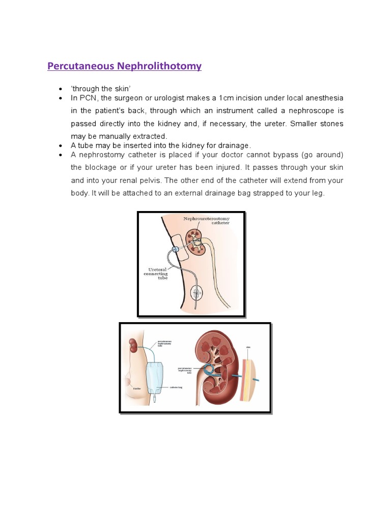 PCN | PDF