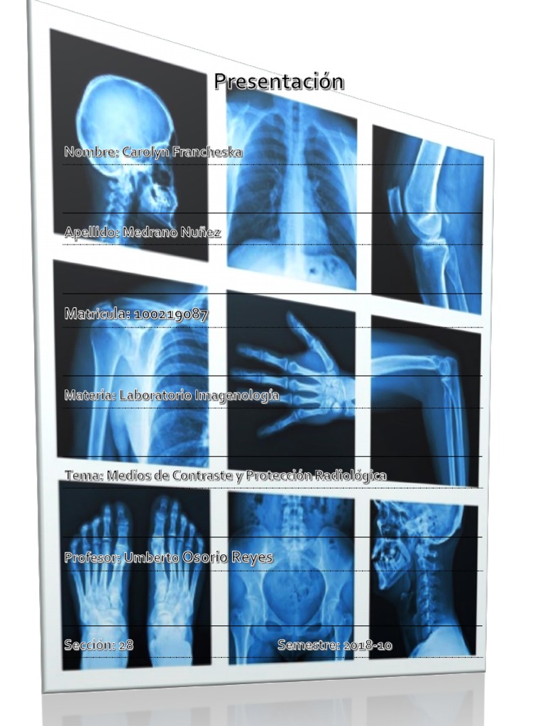 Medios de Contraste imageneologia | Radiación ionizante | Ct Scan