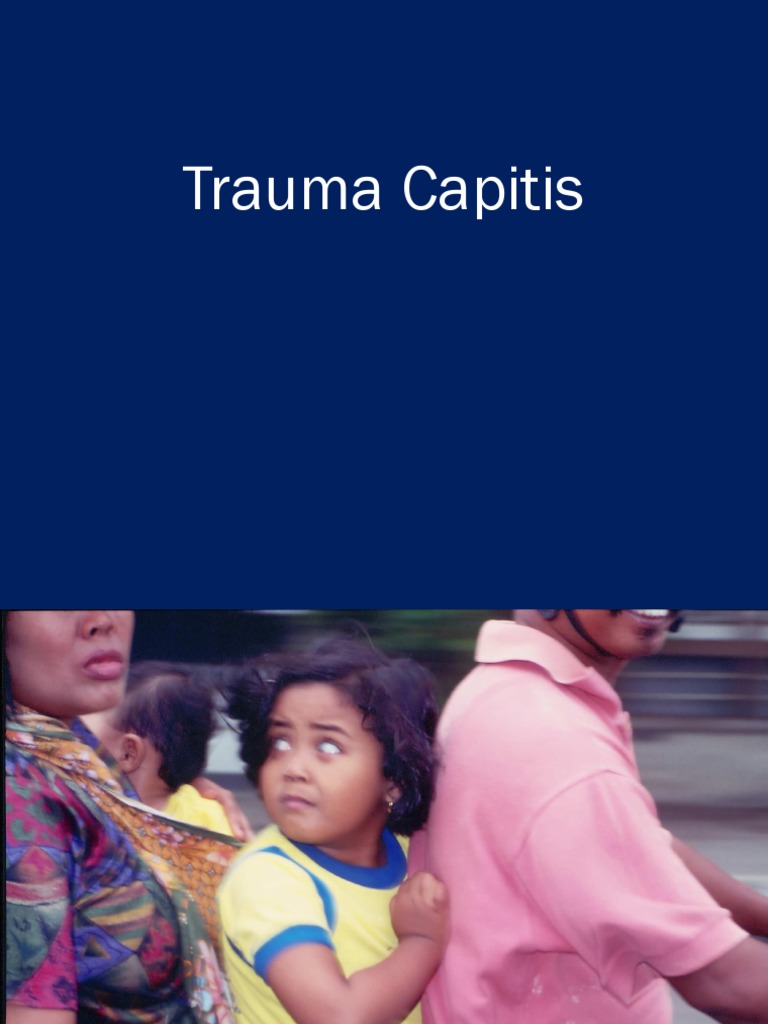 Trauma Capitis | PDF