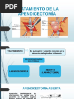 Pasos Quirúrgicos para La Cesárea Tipo Kerr | PDF | Abdomen | Seccion ...